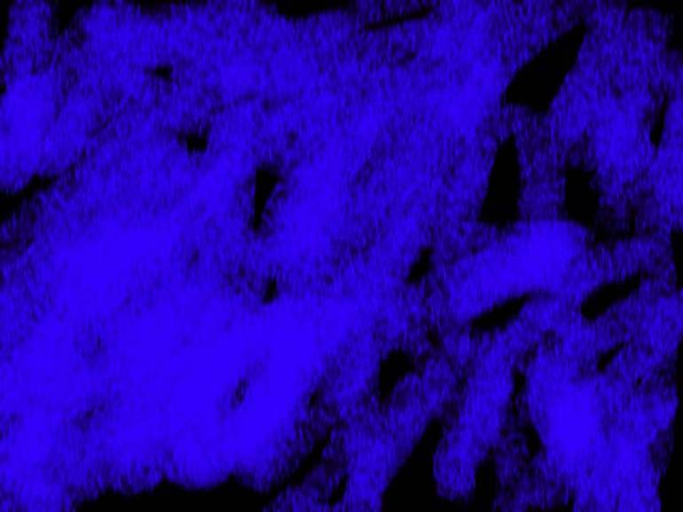 Bruise pristine Painting by mathew rudd | Saatchi Art