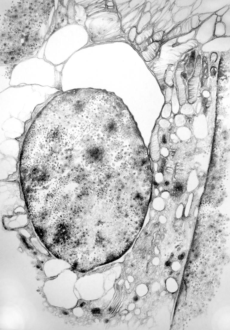 Diagnosis Drawing by Sehee Kim | Saatchi Art
