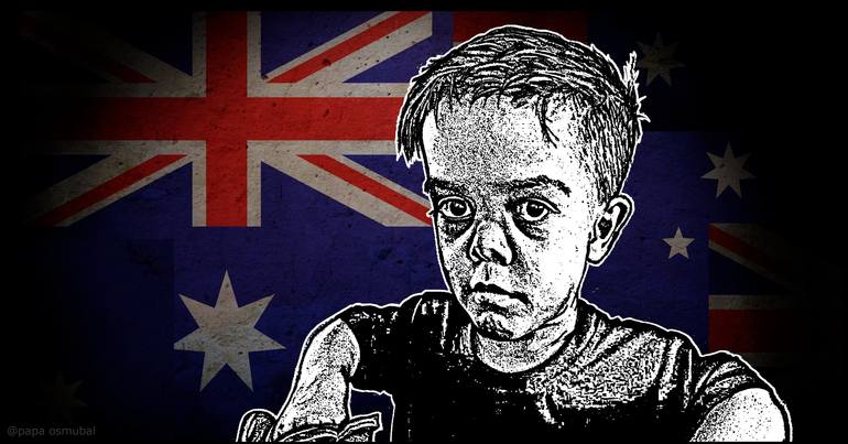 Quaden Bayles-- Australian with Dwarfism, a Victim of Bullying Mixed ...